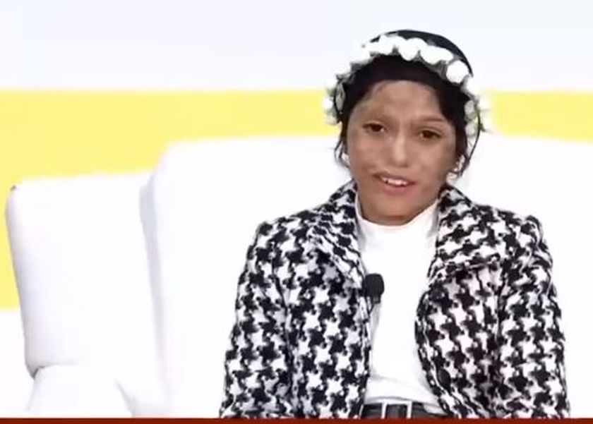 هن | «بسملة» استجاب لها الرئيس بعد استغاثتها: «اشتعلت النار فيها بسبب ...